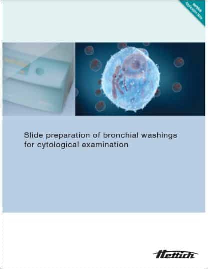Bronchial Washings Application Note | Hettich North America