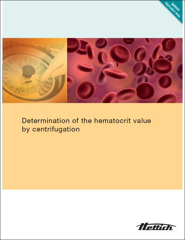 Hematocrit Determination Application Note | Hettich